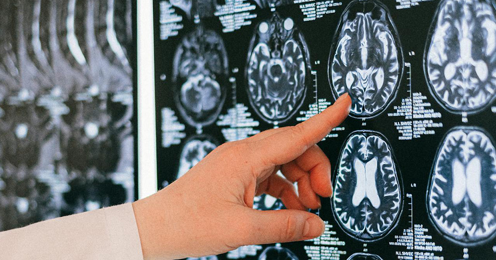 What Is Neurology | Types Of Neurology And Neurologists